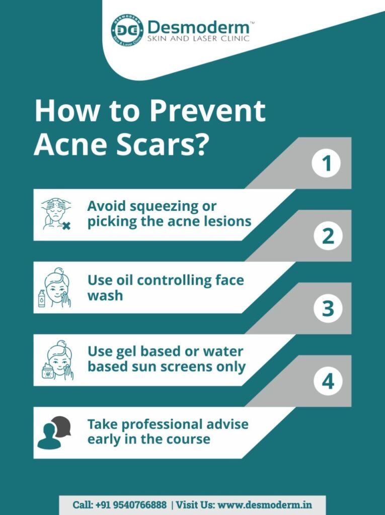 Tips How to get rid of acne scars on face | Desmoderm